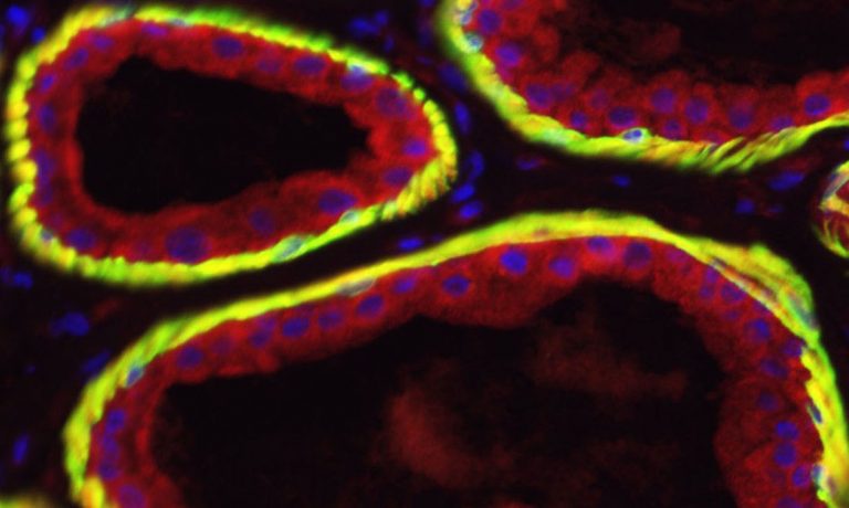 The Lu Lab – AT NYU GROSSMAN SCHOOL OF MEDICINE